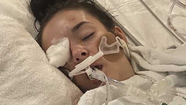 Cheerleader recovers after horrific wreck that caused brain injuries ...